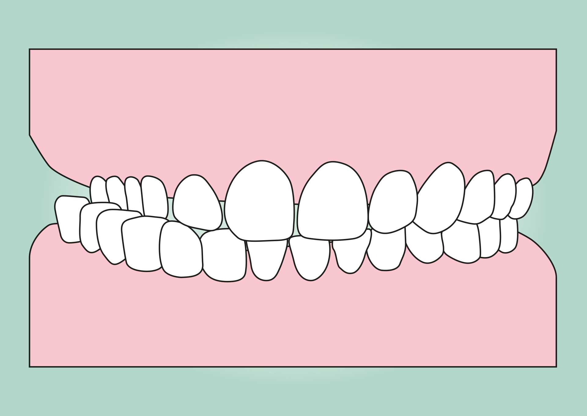 Kinder & Teenager - bioBite