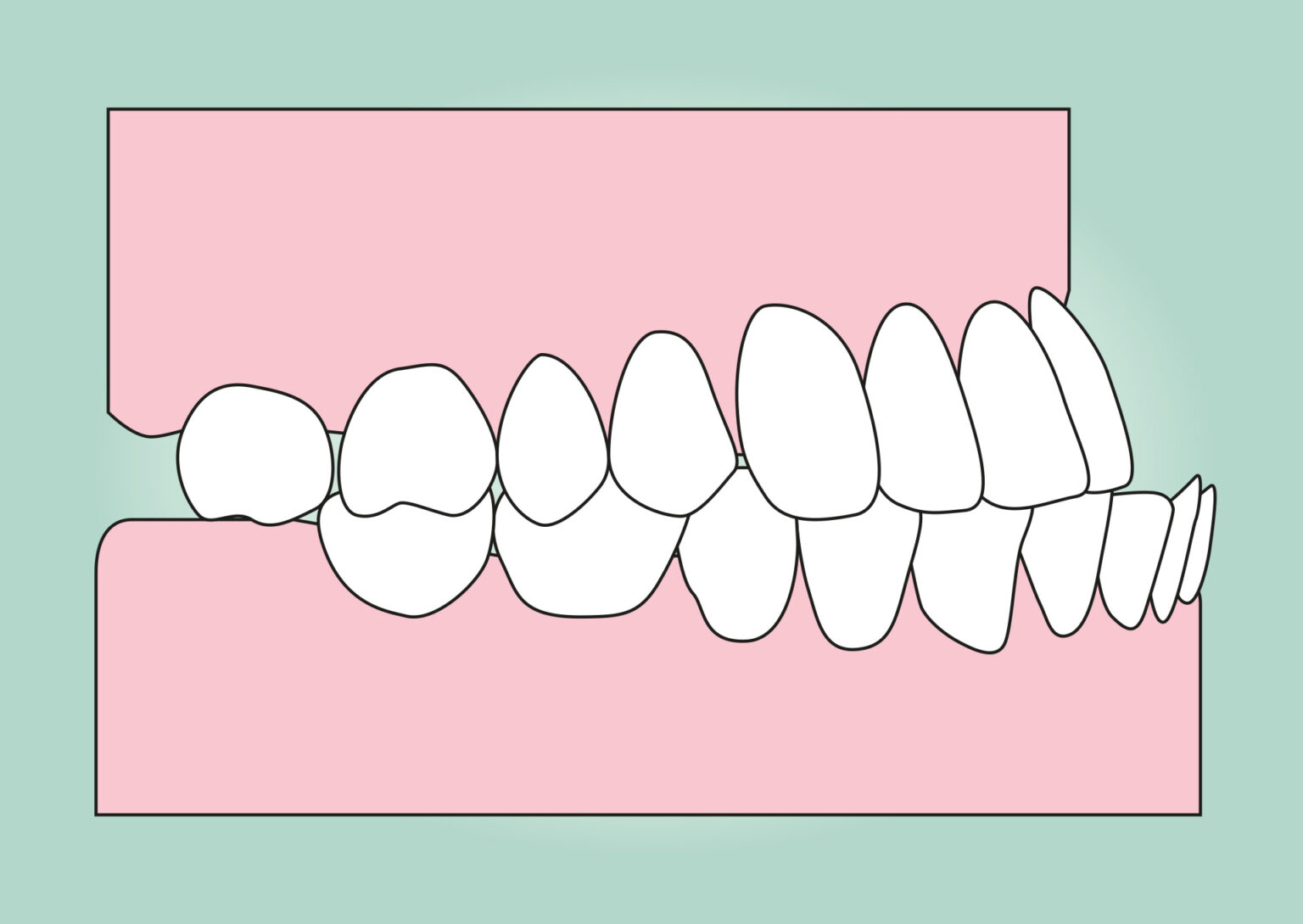 Kinder & Teenager - bioBite