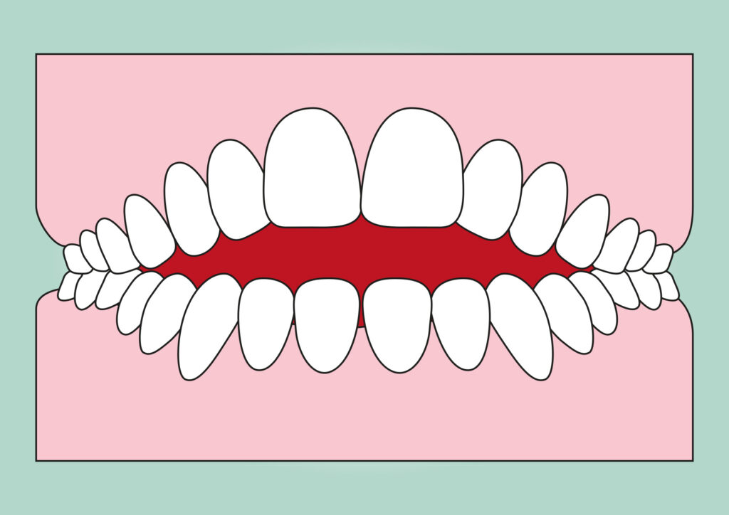 Kinder & Teenager - bioBite